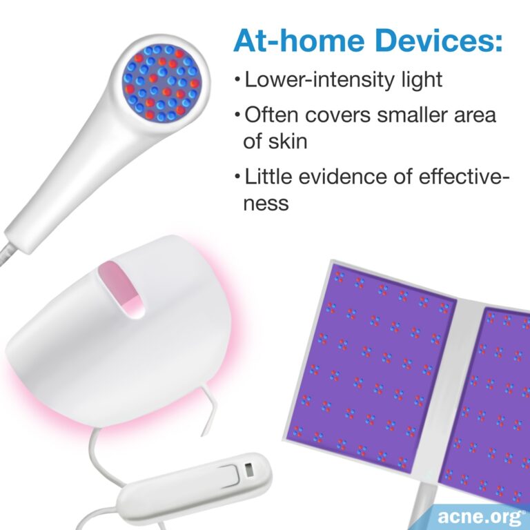 Light Therapy - Blue and/or Red Light - Acne.org