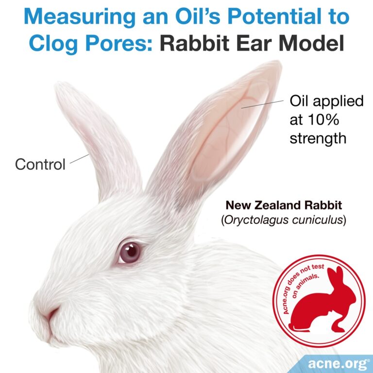 What Is Comedogenic? Understanding Acne-Causing Ingredients