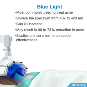 Light Therapy - Blue and/or Red Light - Acne.org
