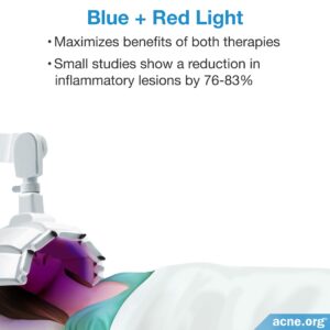 Light Therapy - Blue and/or Red Light - Acne.org