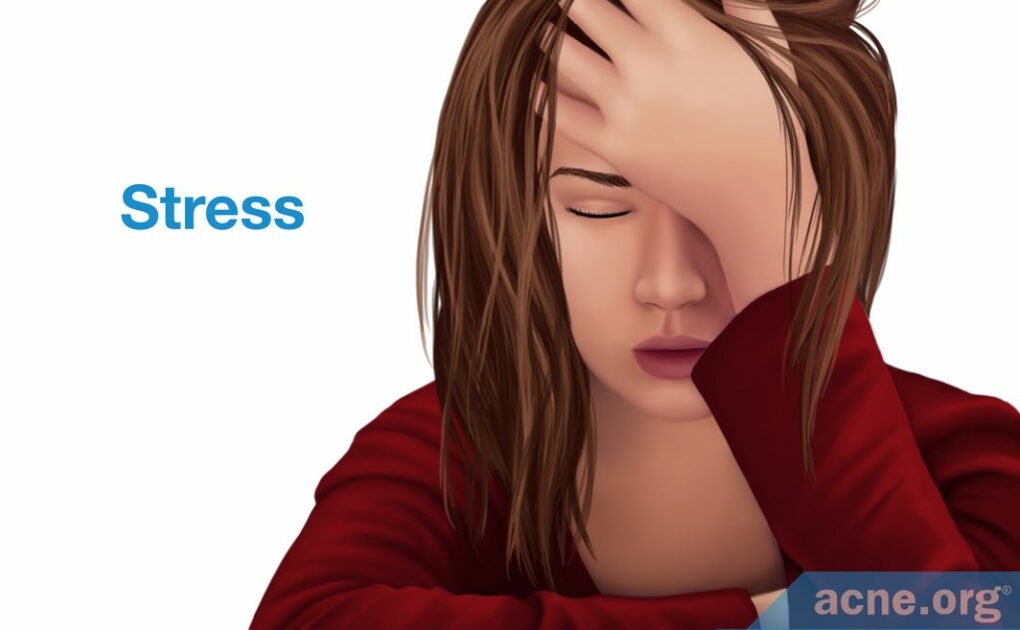 The Causes of Acne That You Should Know About - Acne.org