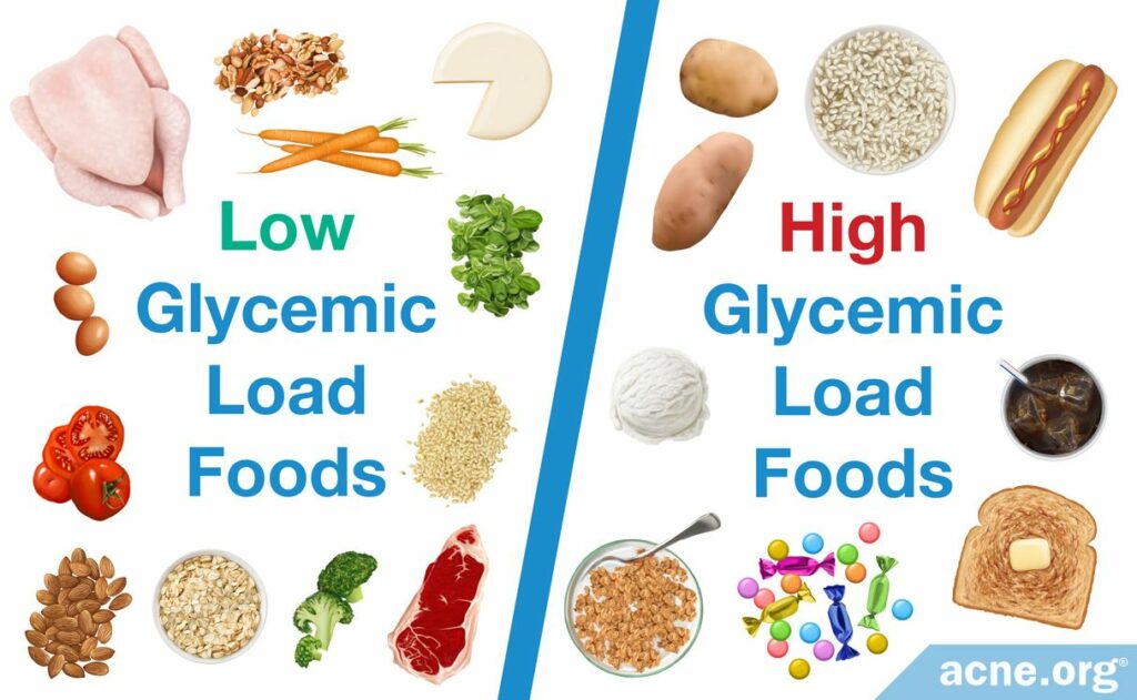 Glycemic Load Diet and Acne - Acne.org