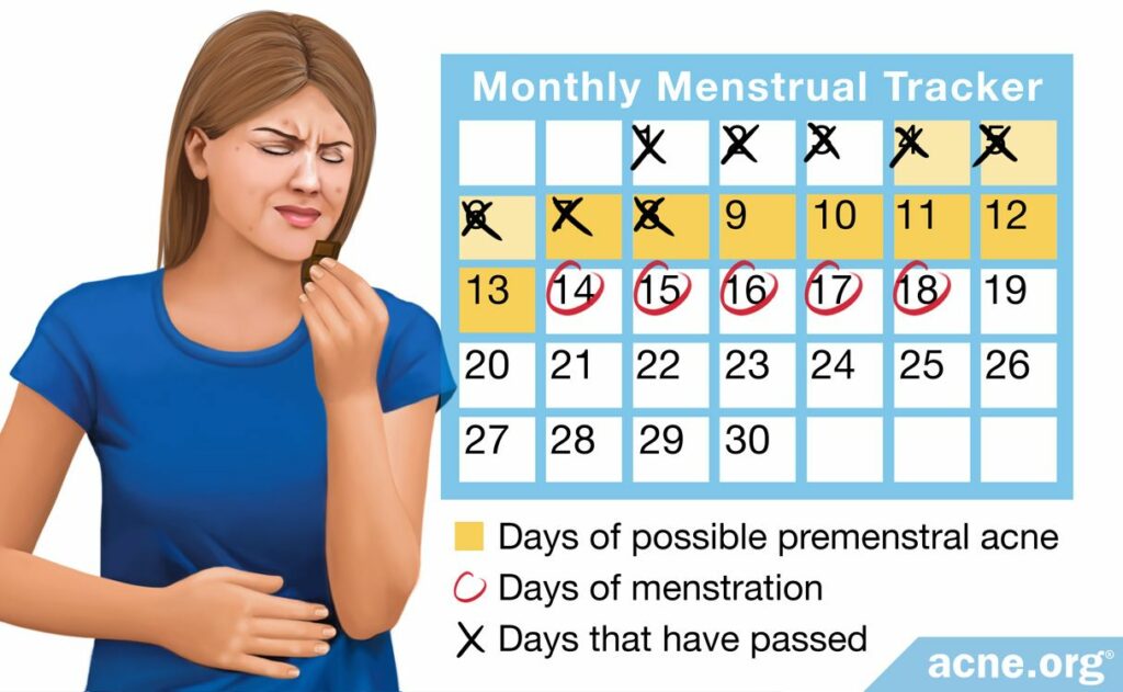 Premenstrual Acne - Acne.org