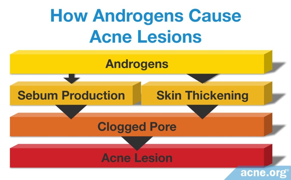 The Role of Hormones in Acne - Acne.org