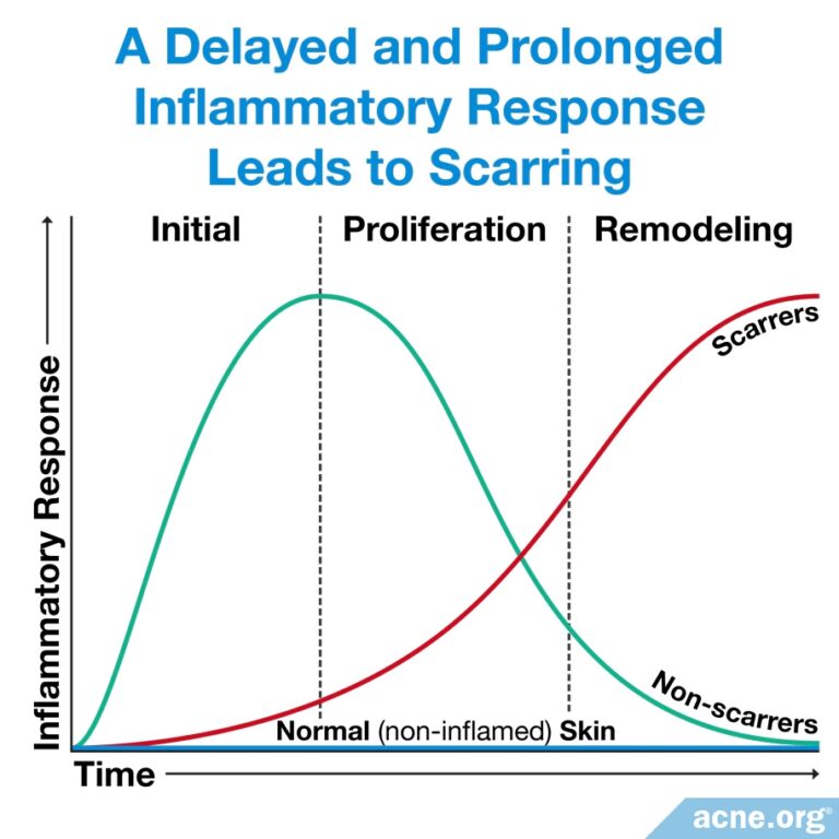 What Causes a Pimple to Scar? - Acne.org