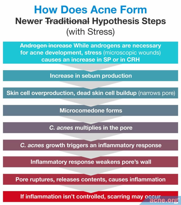 What Is Acne - An In-depth Look - Acne.org