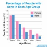 When Will I Grow Out of Acne? Statistics and Factors | Acne.org
