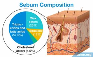 What Is Acne - An In-depth Look - Acne.org