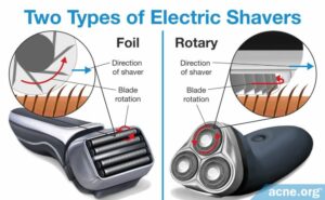 Blade Shaving Vs. Electric Shaving-Which Is Better for Your Skin ...