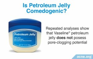 What Is Comedogenicity, and What Ingredients Are Comedogenic? The Full ...