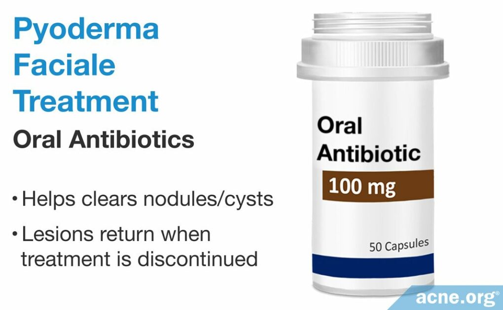 What Is Pyoderma Faciale? - Acne.org