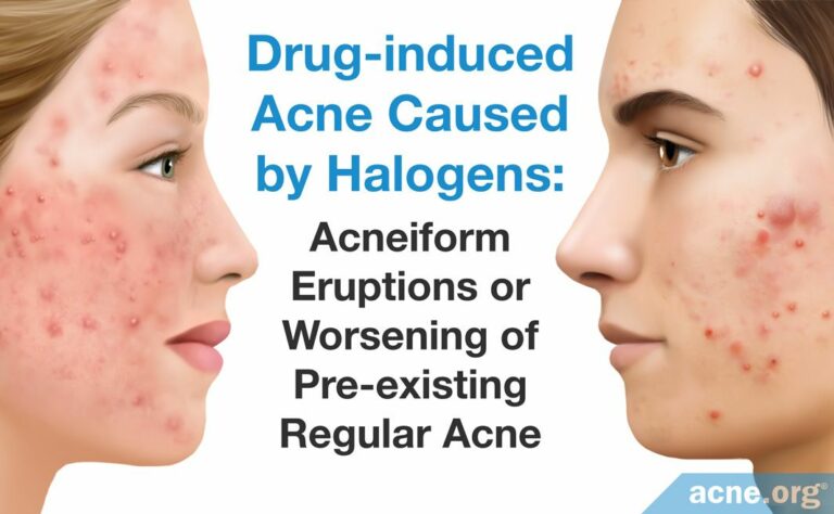 Medications That Cause Acne: Common Culprits Explained - Acne.org