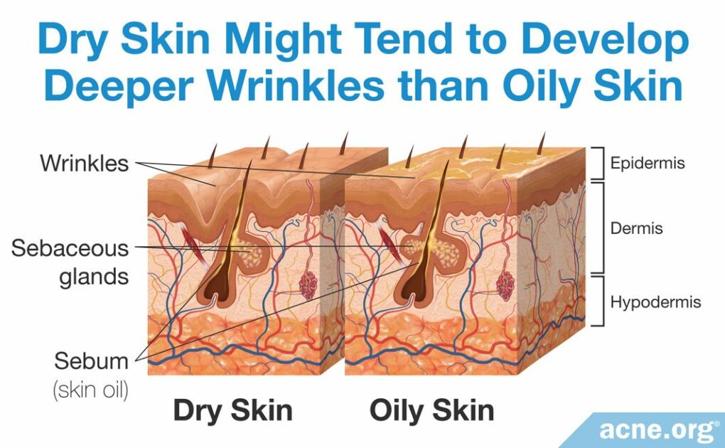 Which Skin Type Ages Faster? - Acne.org