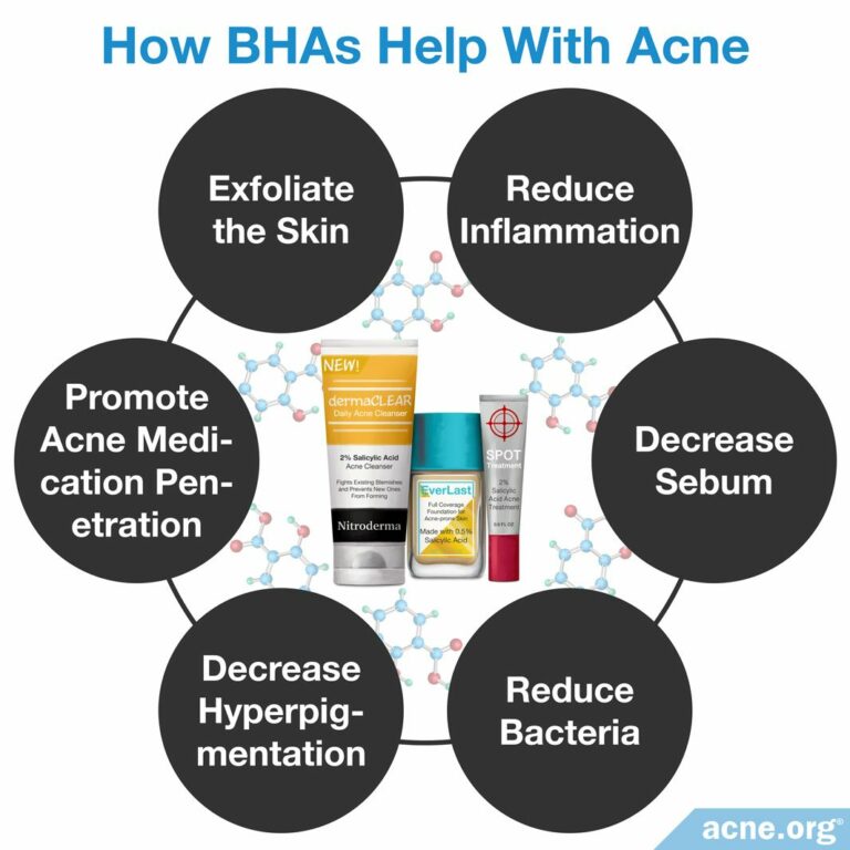 How Beta Hydroxy Acids (BHAs) Help with Acne - Acne.org