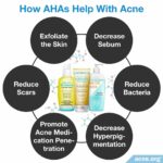 How Alpha Hydroxy Acids (AHAs) Help with Acne - Acne.org