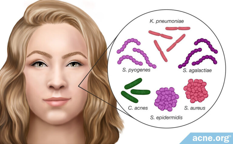 Do Different Strains of Acne Bacteria Affect Acne Differently? - Acne.org