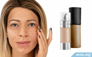 Everything about Acne & Scars - Acne.org