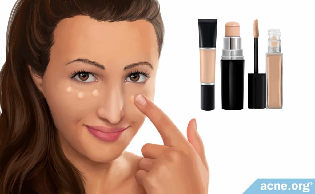 How to Choose a Good Concealer - Acne.org