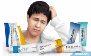 Everything about Acne & Scars - Acne.org