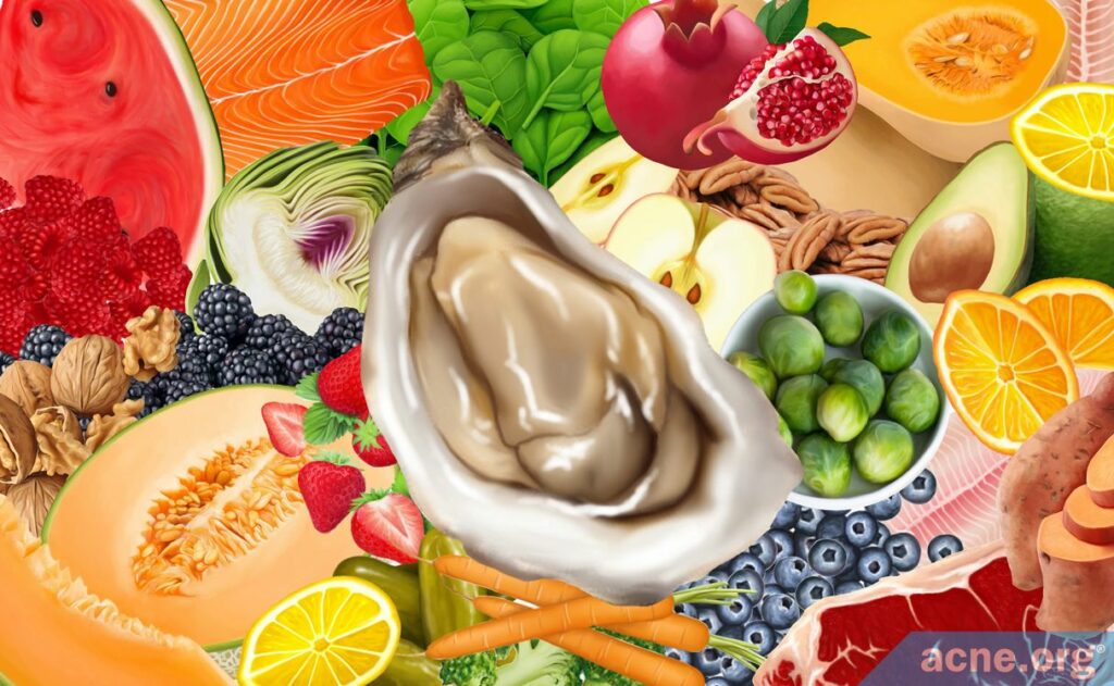 What Are the Best Foods for People with Acne? - Acne.org