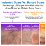 Do Acne Scars Fade with Time? - Acne.org
