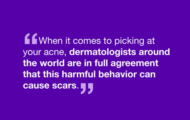 Picking at Pimples Leads to Scars - Acne.org