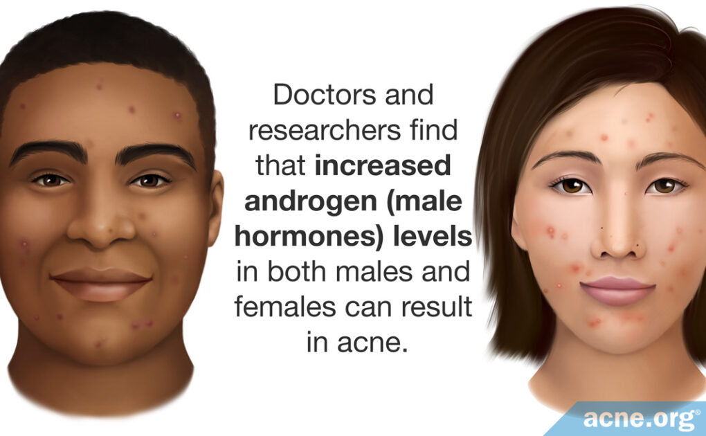 Hormones and Acne: Causes and Solutions Explained - Acne.org