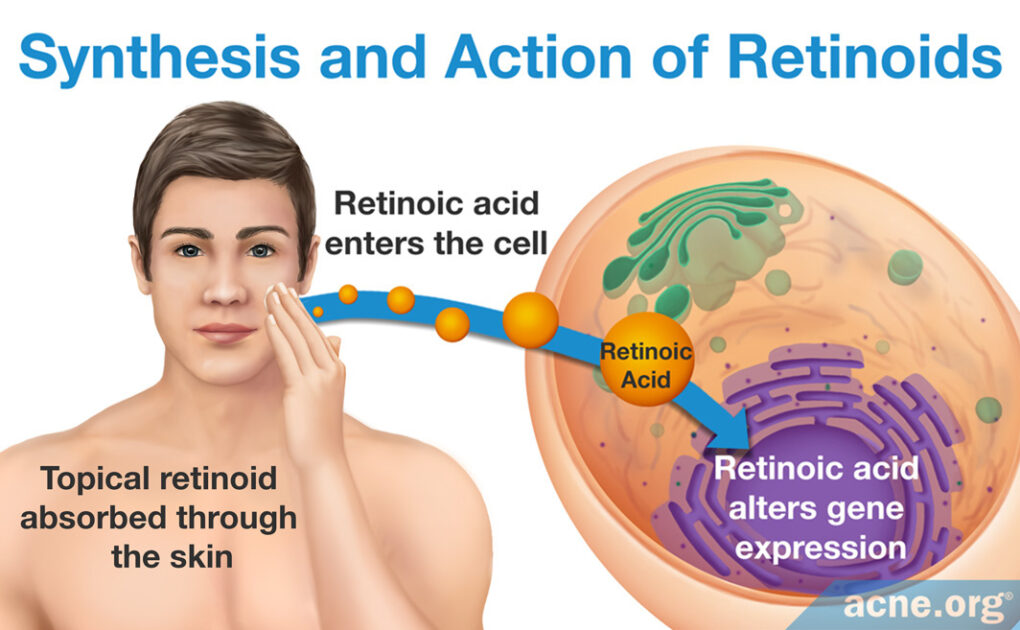 What's the Difference Between Retinol and Retinoids? - Acne.org