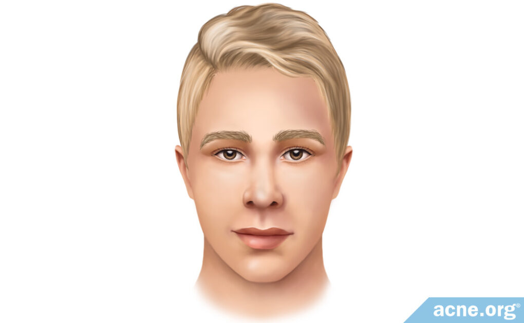 Skin Picking - Acne.org