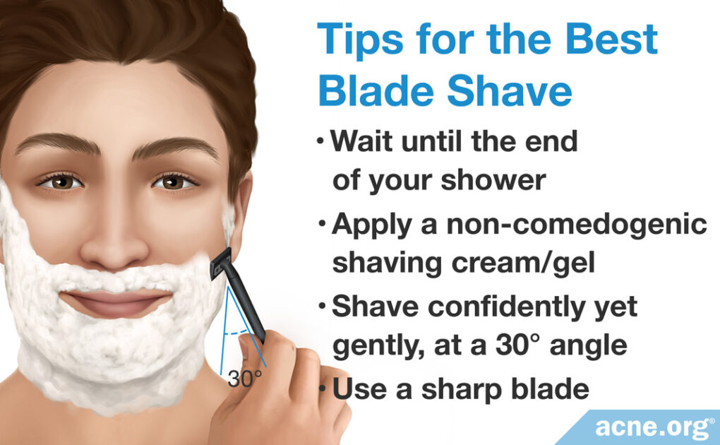 Blade Shaving Vs. Electric Shaving-Which Is Better for Your Skin ...
