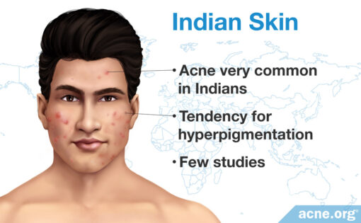 Acne on Indian Skin: Causes & Treatments | Acne.org